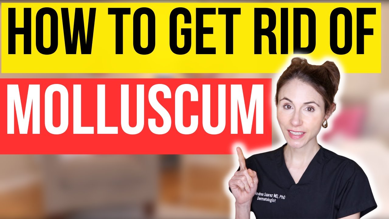 How To Get Rid Of Molluscum FAST | Dermatologist Tips - YouTube