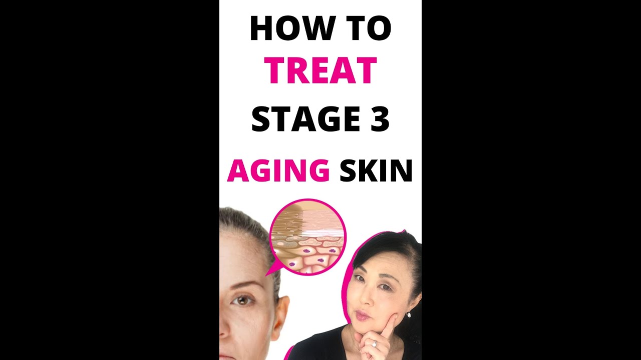 How To Treat Stage 3 Aging Skin #shorts - YouTube