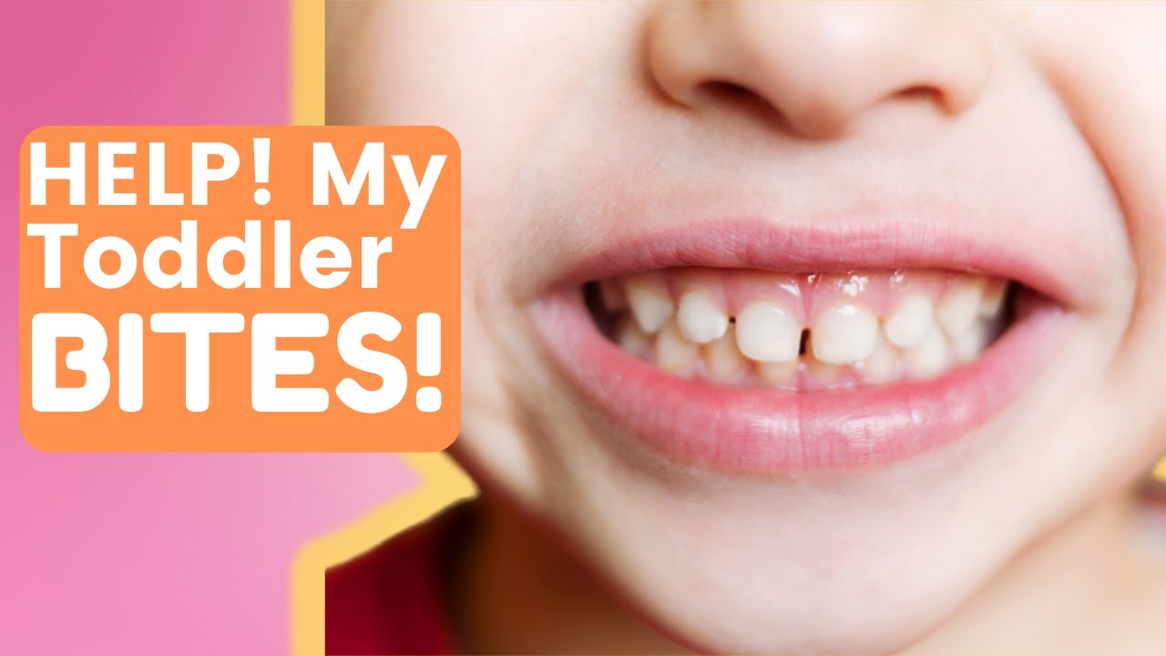 TODDLER BEHAVIOR PROBLEMS, BITING! What to do when your toddler bites ...