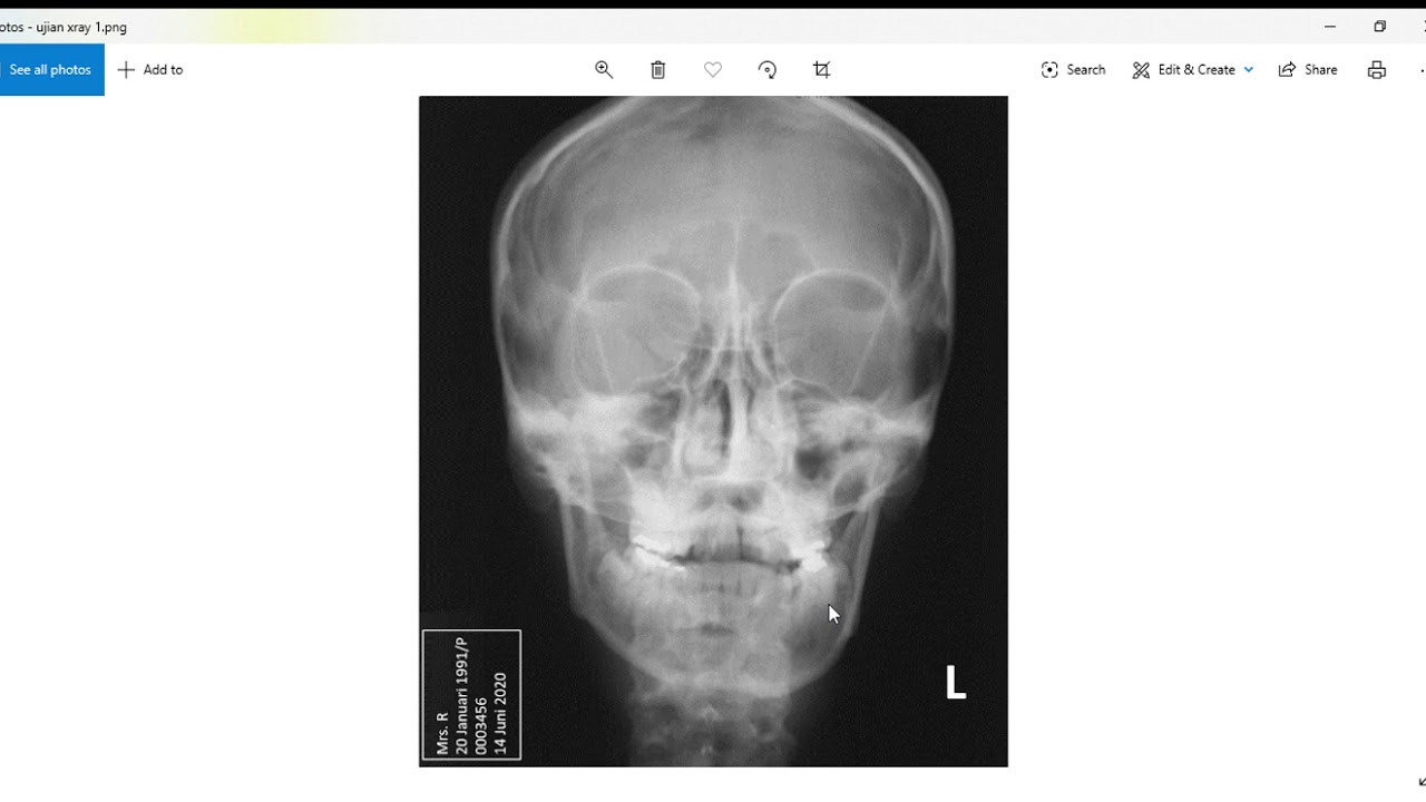 RKK OSCE WHOLE X-RAY EXAMINATION SEMESTER IV : KADEK PUTRI DEVYANTHI ...
