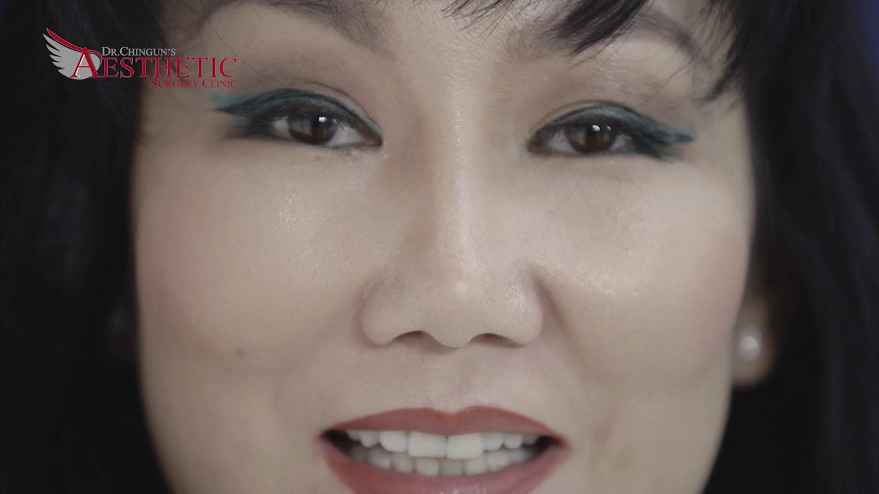 "Dr.CHINGUN-с Асууя" Season 2 #1 " Коллагентэй утас суулгах" - YouTube
