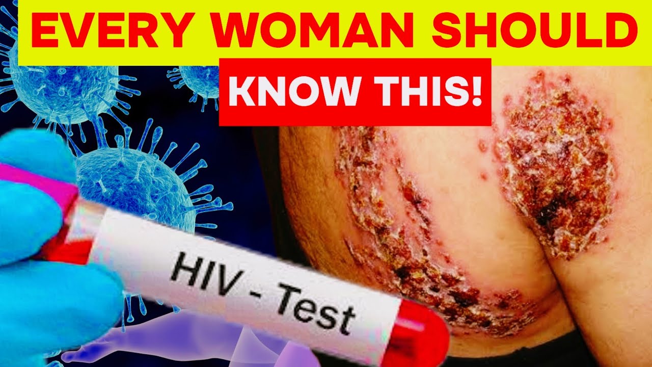 Signs of HIV in Women You Should NEVER Ignore | Detailed Health Guide ...