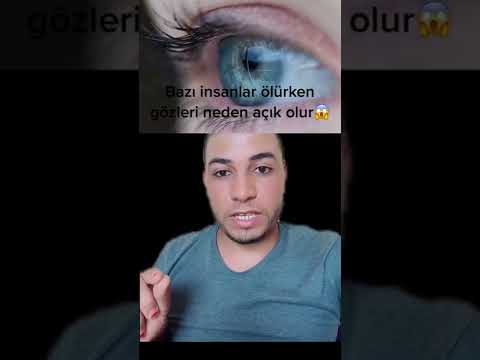 bazı insanlar ölürken gözleri neden açık olsur 😱‼️😱😱😱😱