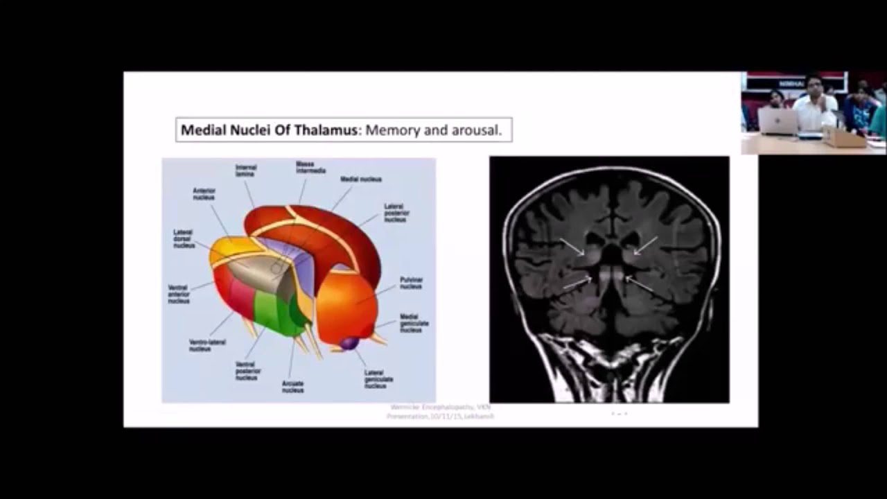 Korsakoff Syndrome byDr Prabhat Chand and Dr Lekhansh Shukla - YouTube