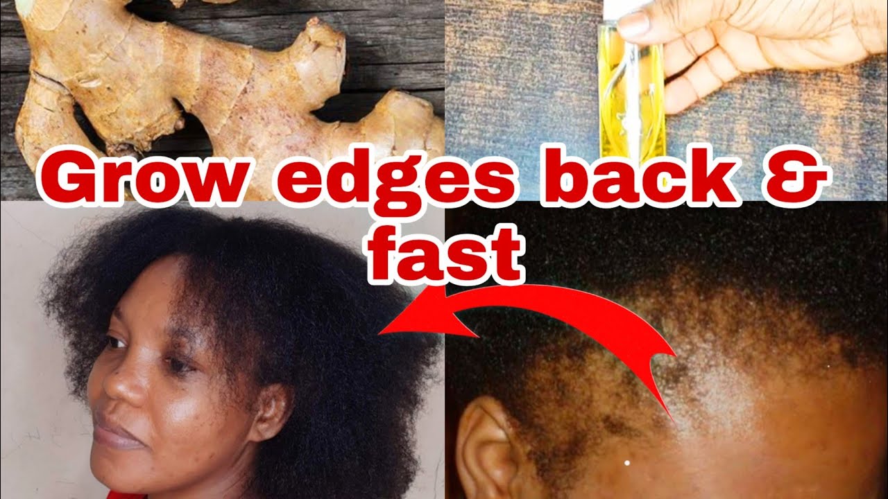 DIY GINGER OIL| REVERSE THINNING HAIR & SAY GOODBYE TO DANDRUFF - YouTube