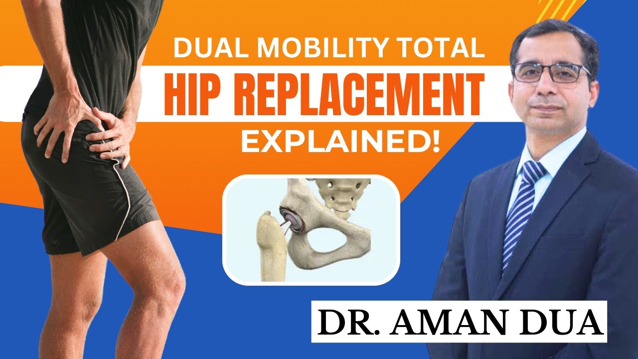 Dual Mobility Total Hip Replacement: Benefits and Procedure Explained ...
