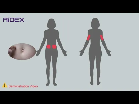 Kuidas Aidex CGM töötab? - Glükoosimonitor See video näitab kuidas ja ...
