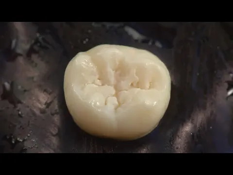 UltraSeal XT Hydro (Ultradent) Гидрофильный герметик ямок, 1,2 мл ᐉ ...
