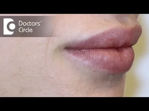 Bump On Upper Lip